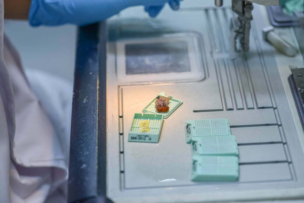 Skin Cancer Audit and Research Data Inc – The next evolution of SCARD